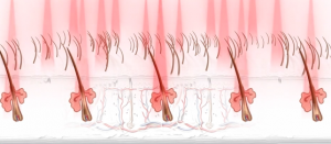 How does the laser cap or Capillus device work? - Pinette Hair