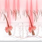 How does the laser cap or Capillus device work? - Pinette Hair